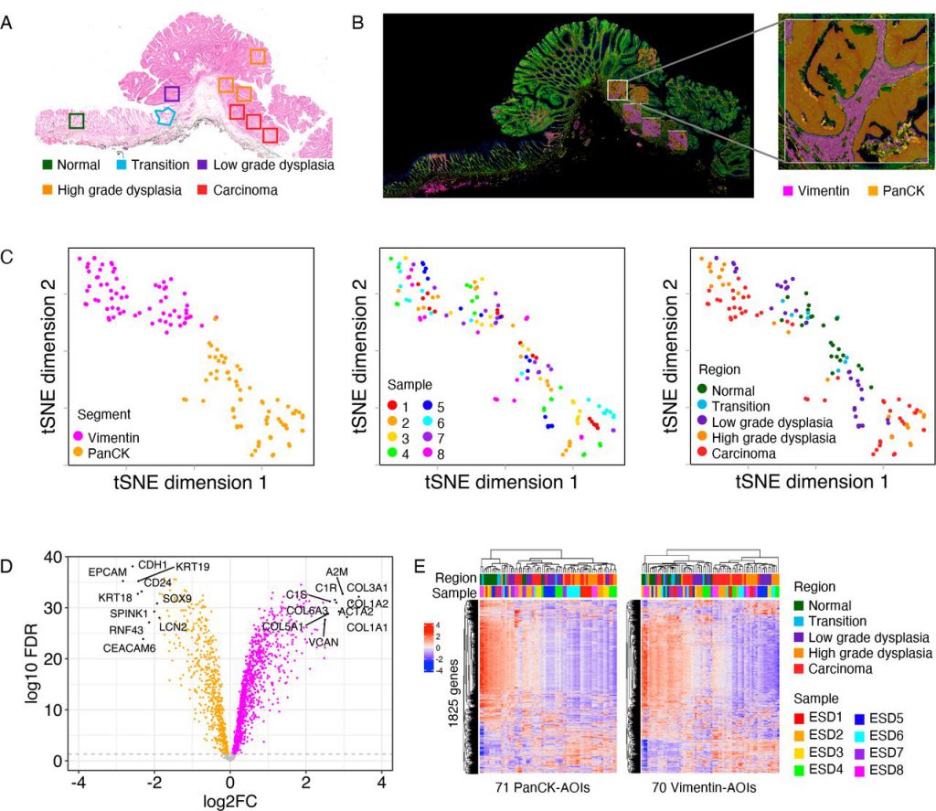 Transcriptional And Immunophenotypic Profiling Reveals Molecular And